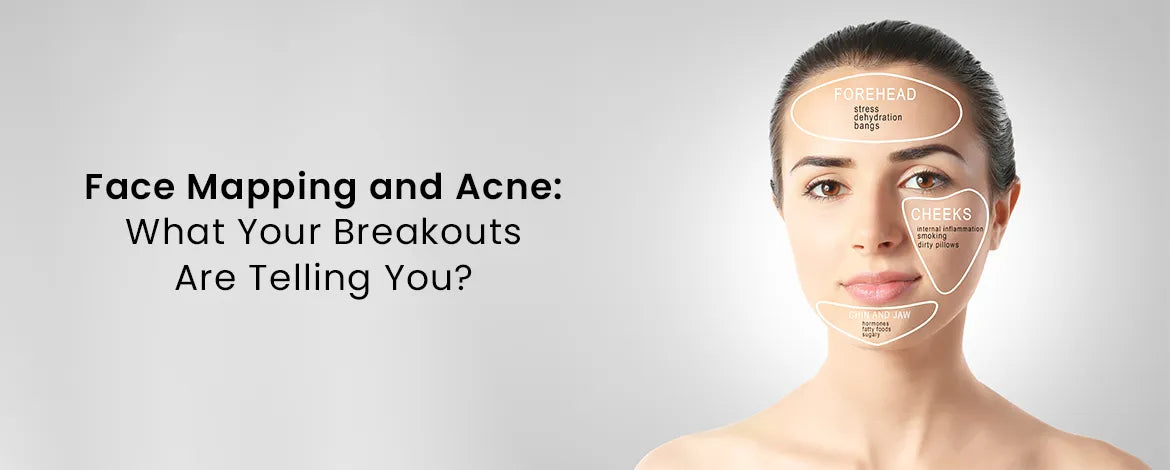 Face Mapping and Acne: What Your Breakouts Are Telling You? – Fixderma ...