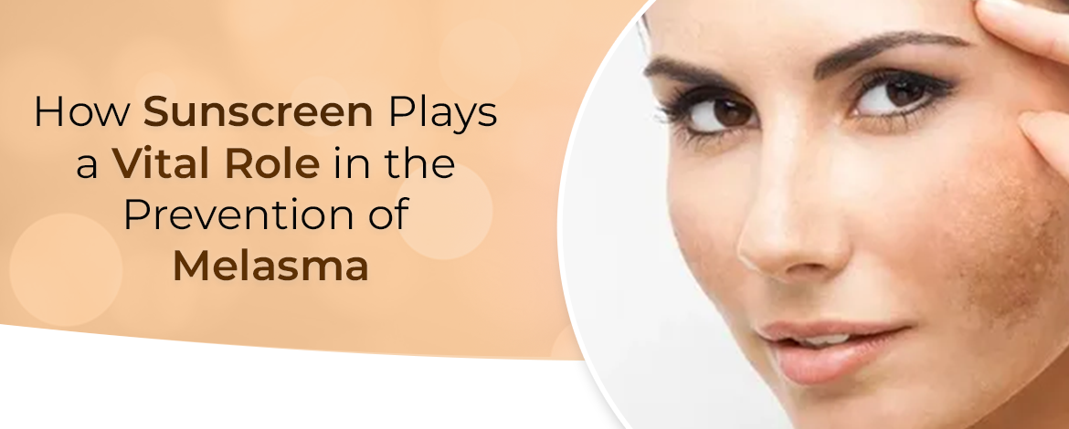 How Sunscreen Plays a Vital Role in the Prevention of Melasma ...