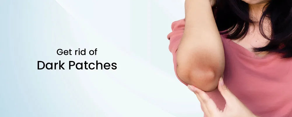 Why your elbows, knees, neck, and underarms are dark? – Fixderma Skincare