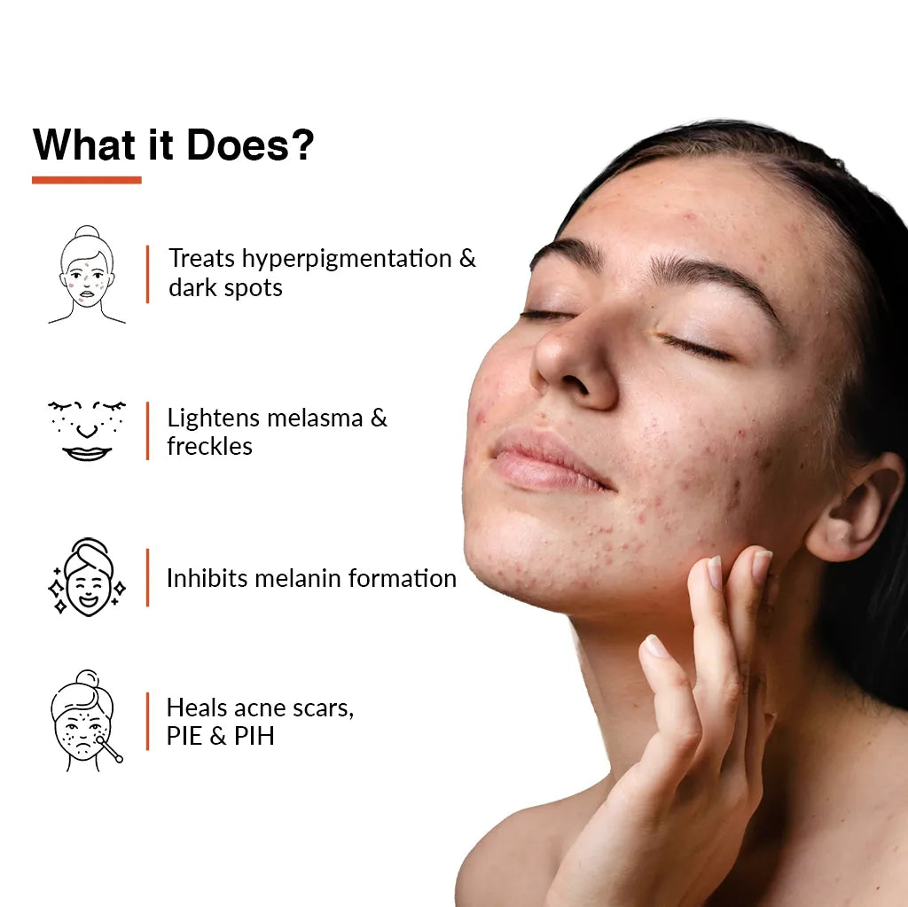 Melasma Treatment Bundle – Fixderma Skincare